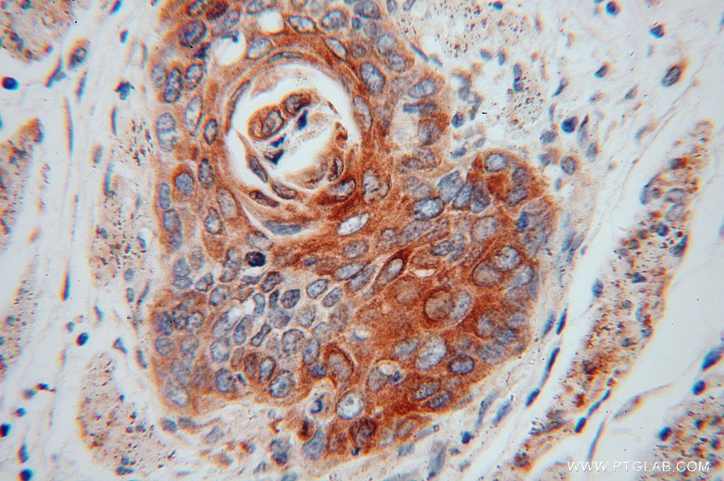 ERGIC1 Antibody 16108-1-AP | Proteintech