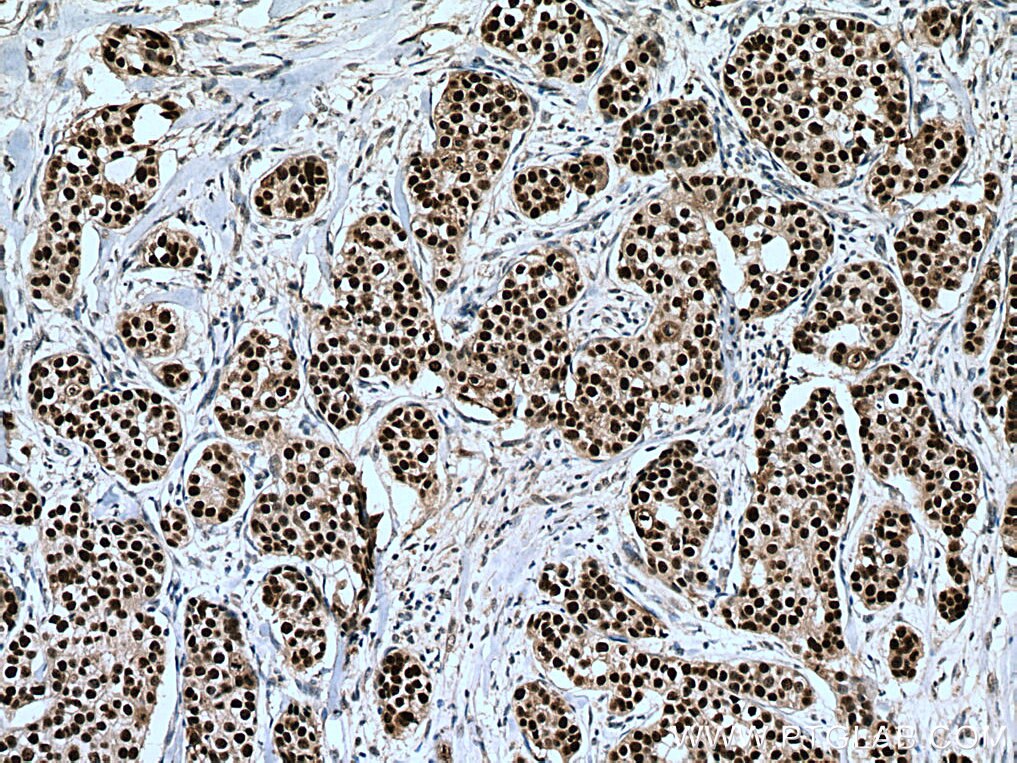 ER Antibody 21244-1-AP | Proteintech