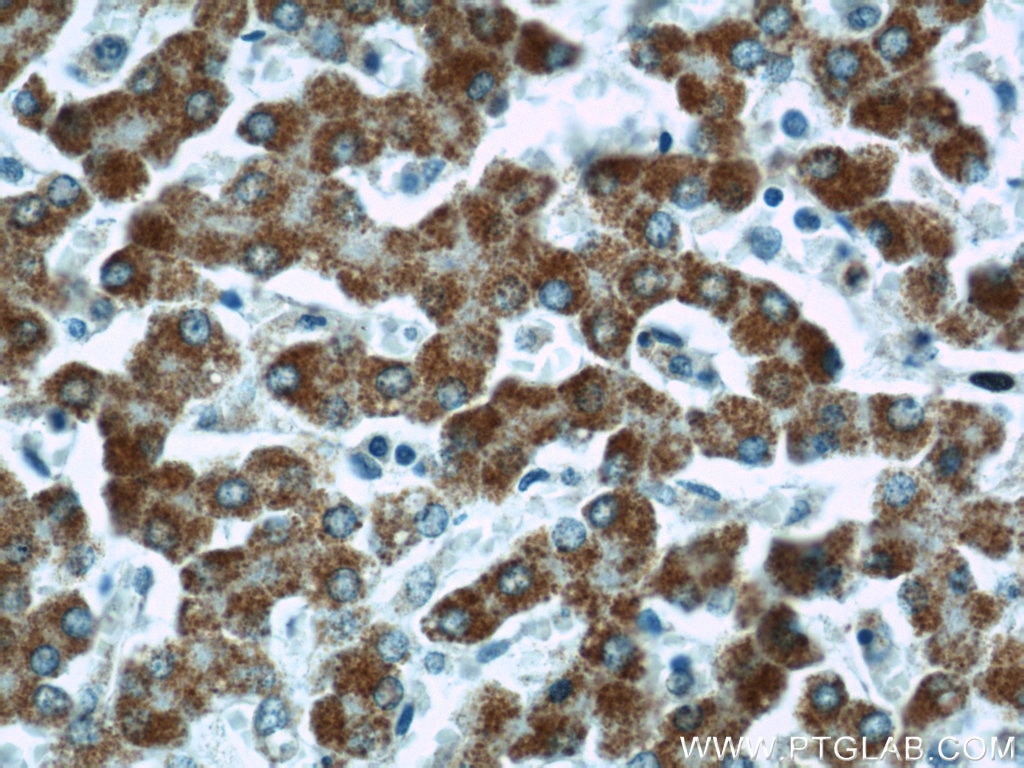Factor XII Antibody 12551-1-AP | Proteintech