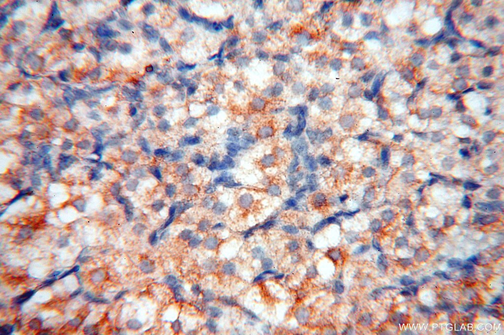 FABP3 Antibody 10676-1-AP | Proteintech