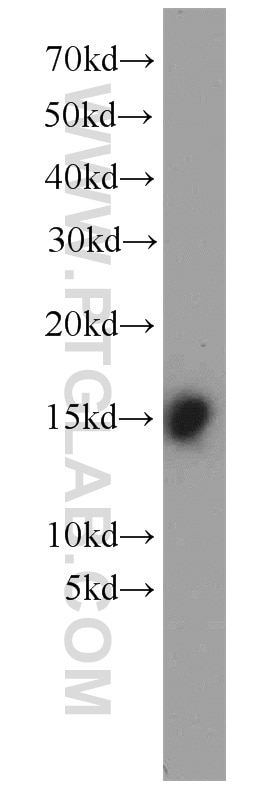FABP3 Antibody 10676-1-AP | Proteintech