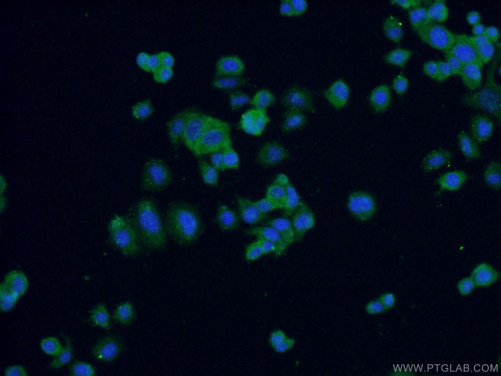 FABP7 antibody (17456-1-AP) | Proteintech