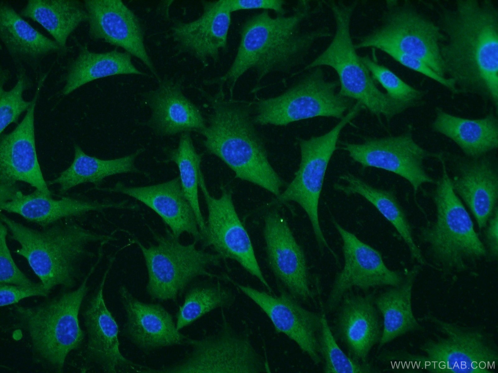 FGF5 Antibody 18171-1-AP | Proteintech