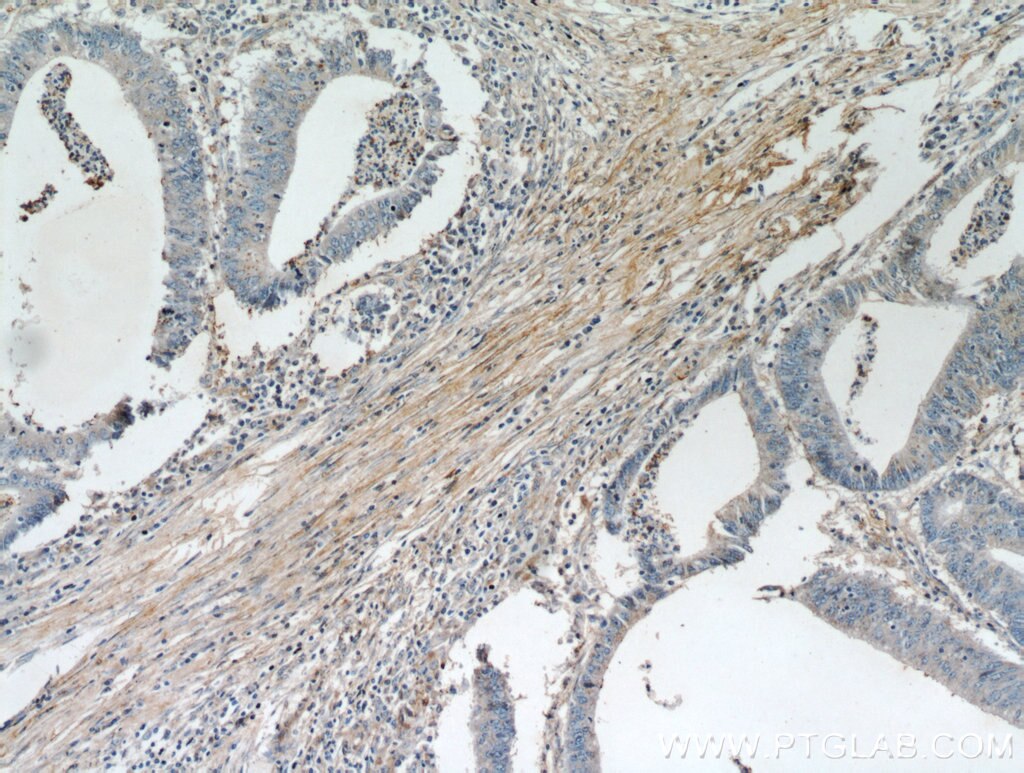 Fibronectin Antibody 15613-1-AP | Proteintech