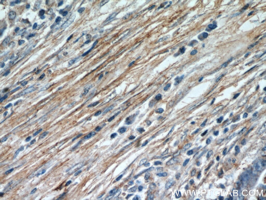 Fibronectin Antibody 15613-1-AP | Proteintech