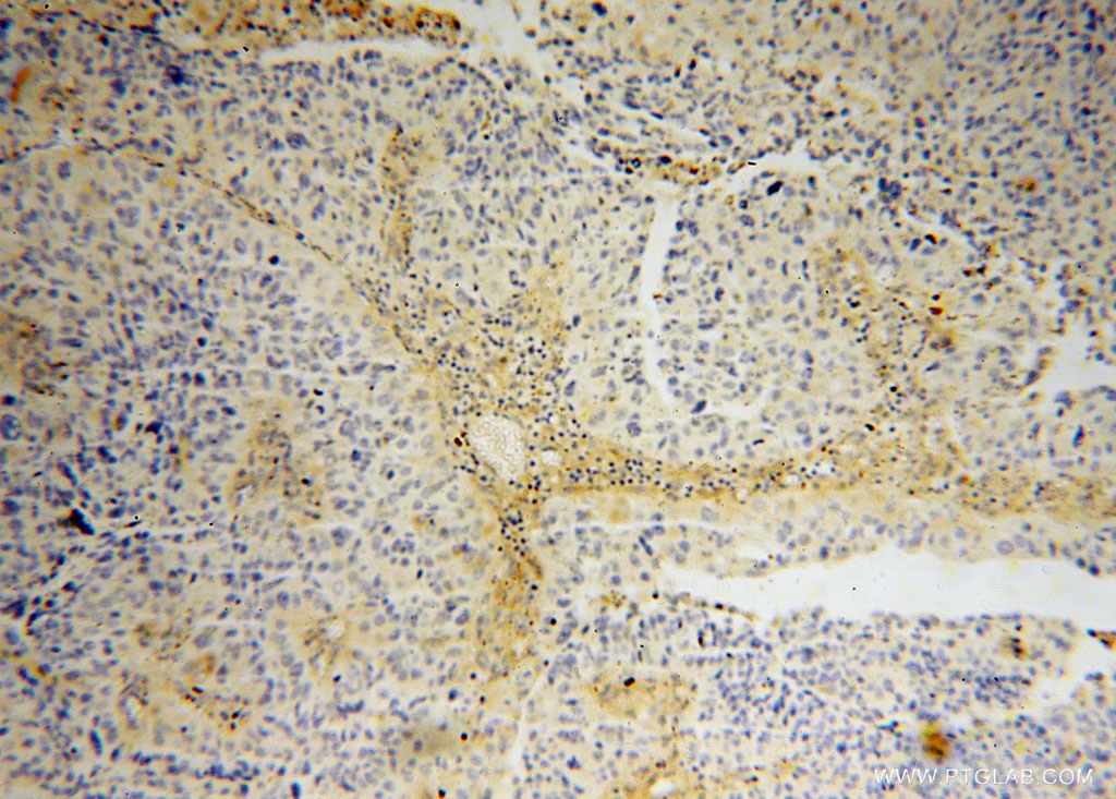 Fibronectin Antibody 15613-1-AP | Proteintech