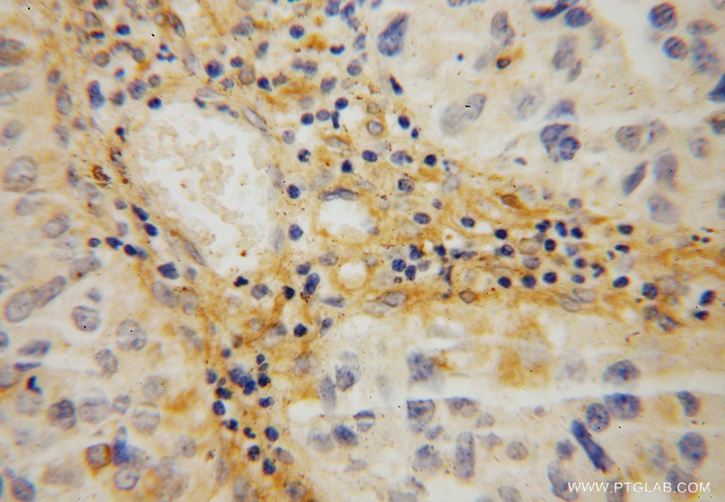 Fibronectin Antibody 15613-1-AP | Proteintech