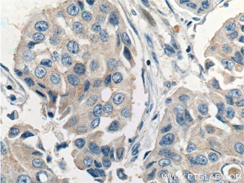 FOLR1 antibody (23355-1-AP) | Proteintech