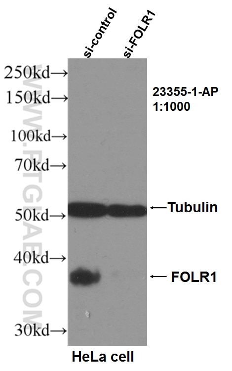 FOLR1 antibody (23355-1-AP) | Proteintech