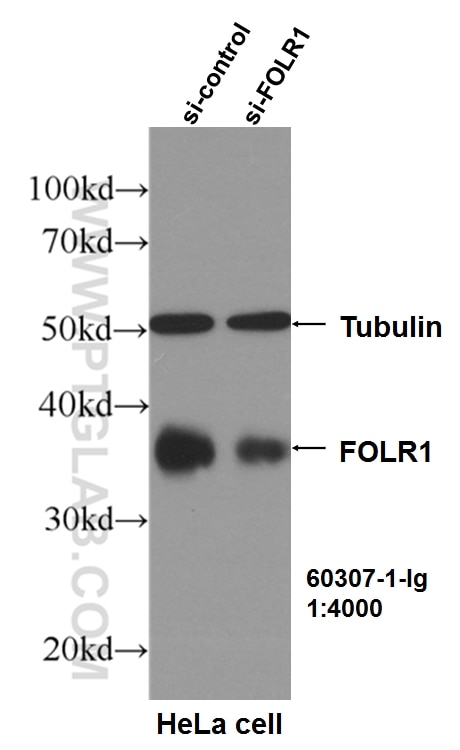 FOLR1 antibody (60307-1-Ig) | Proteintech