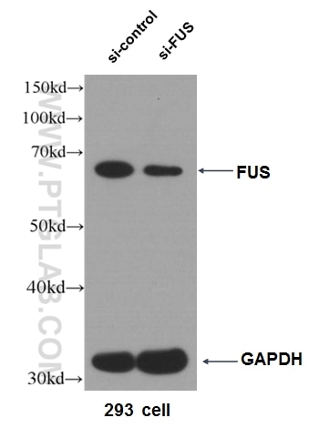 FUS/TLS antibody (11570-1-AP) | Proteintech