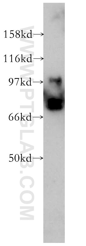 FXR1 Antibody 13194-1-AP | Proteintech