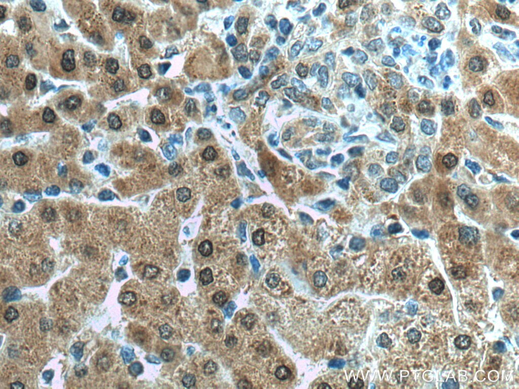 GAMT antibody (10880-1-AP) | Proteintech