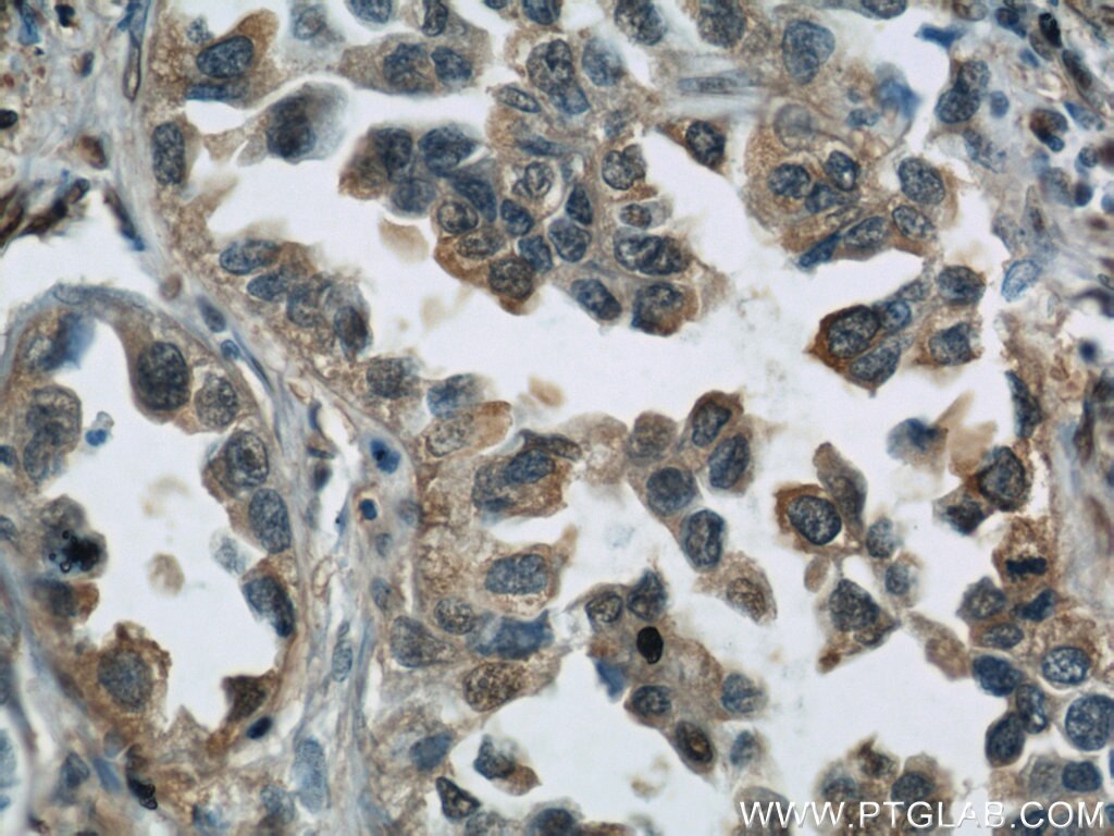 GAPDH antibody (10494-1-AP) | Proteintech