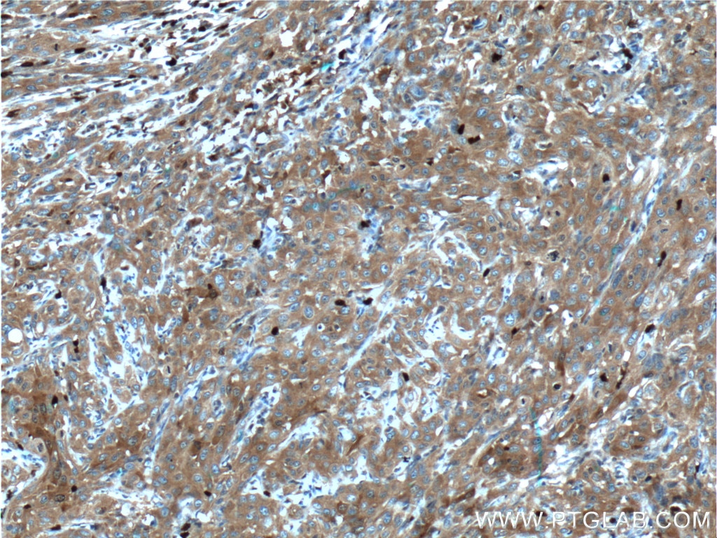 GART antibody (13659-1-AP) | Proteintech
