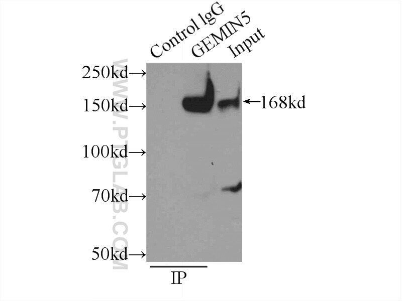 GEMIN5 Antibody 24897-1-AP | Proteintech