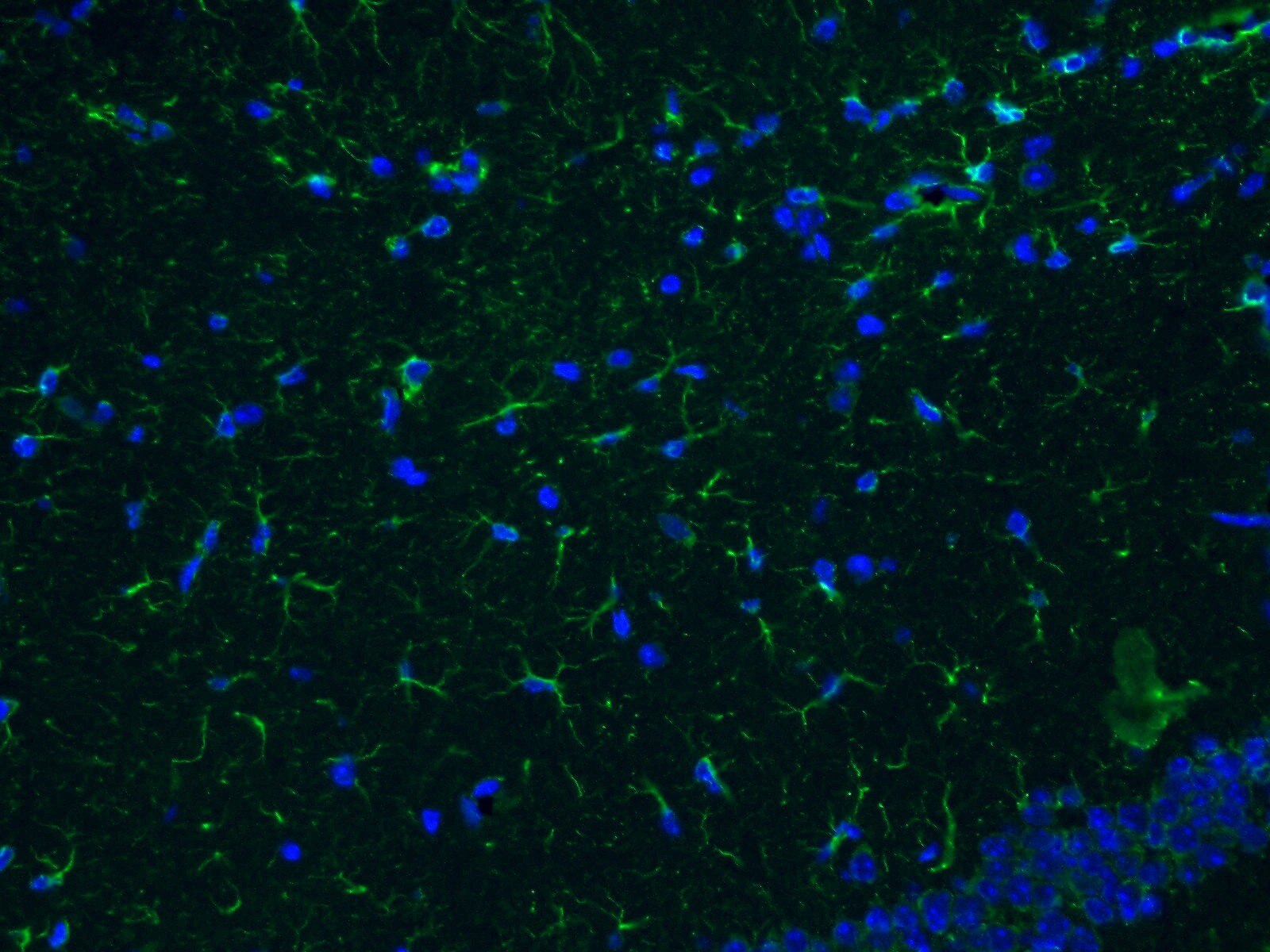 GFAP Antibody 16825-1-AP | Proteintech