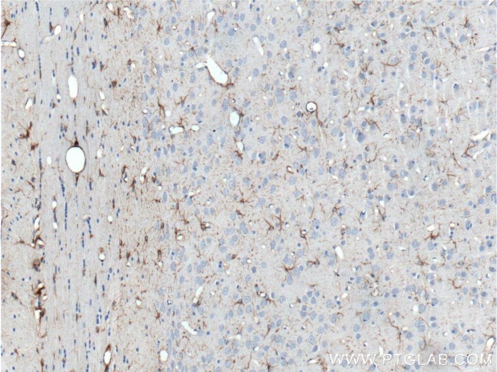 GFAP Antibody 60190-1-Ig | Proteintech