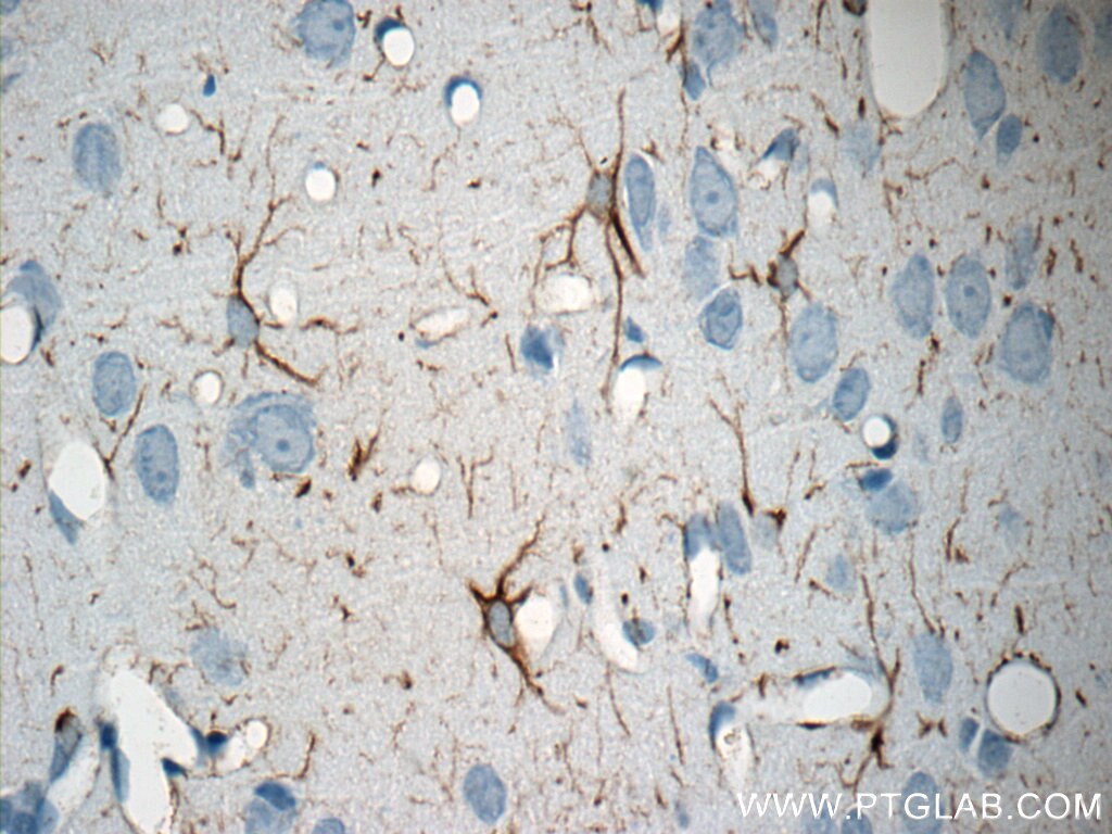 GFAP Antibody 60190-1-Ig | Proteintech