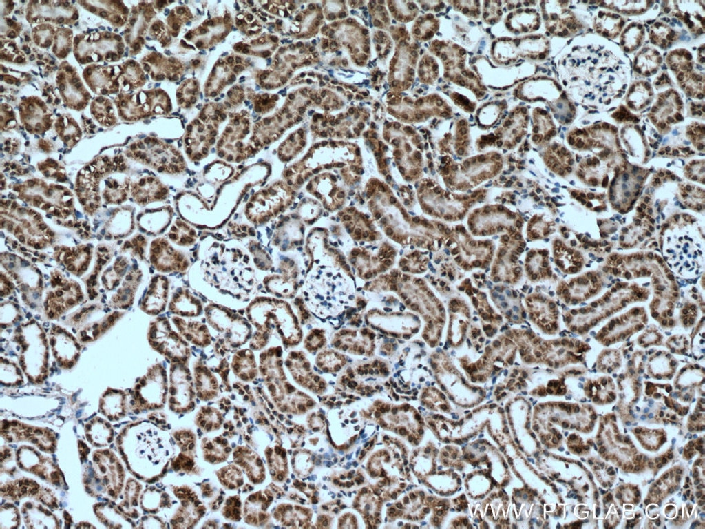 GOLGA2/GM130 Antibody 11308-1-AP | Proteintech