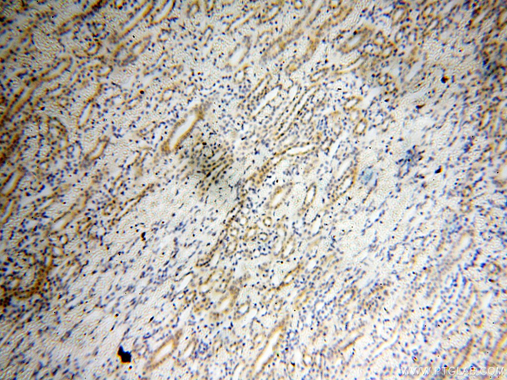 GOLGA2/GM130 Antibody 11308-1-AP | Proteintech