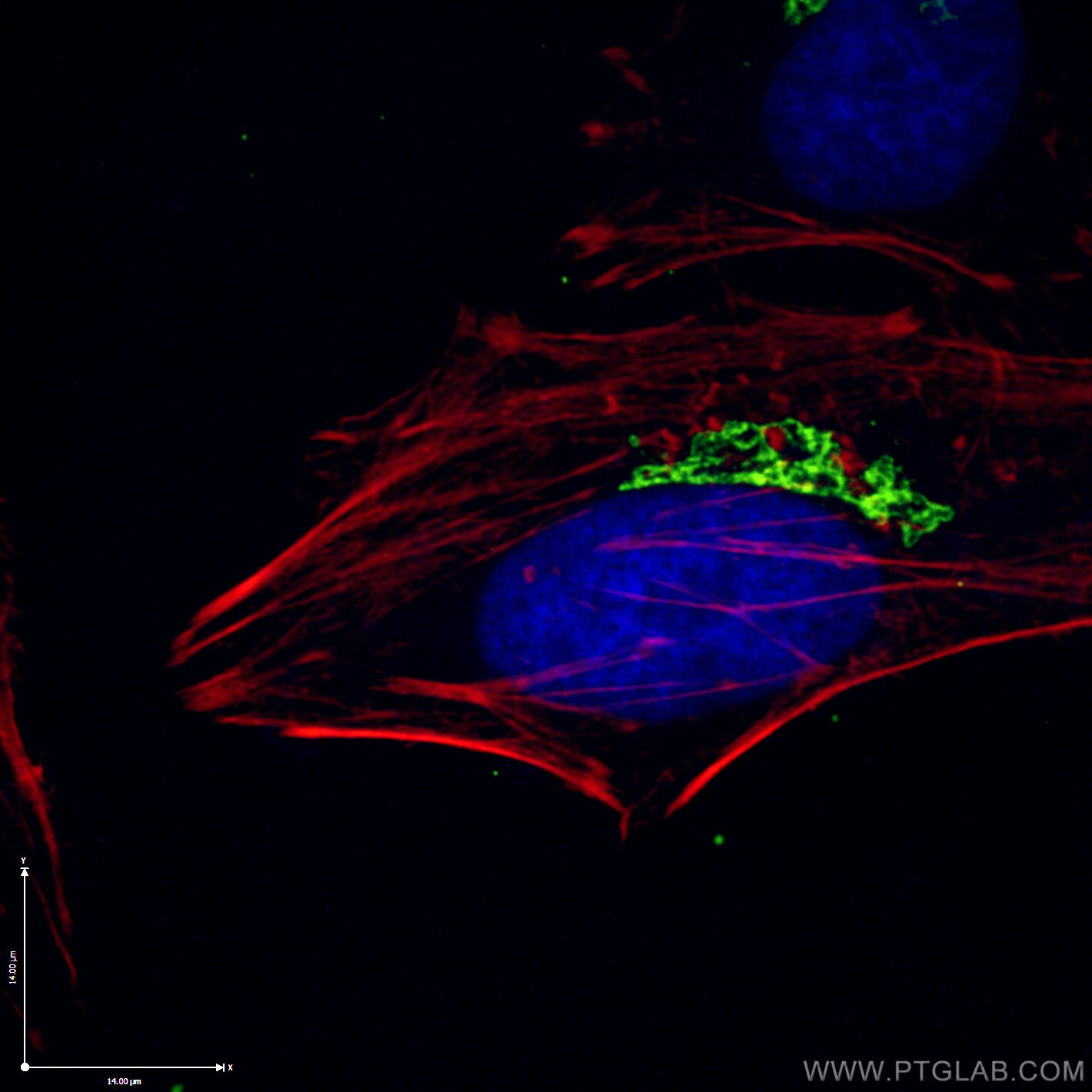 GP73/GOLPH2 Antibody 15126-1-AP | Proteintech