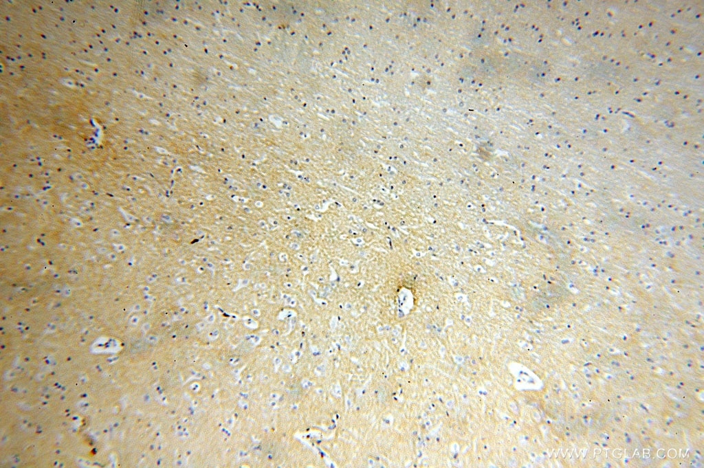 GPM6A Antibody 15044-1-AP | Proteintech