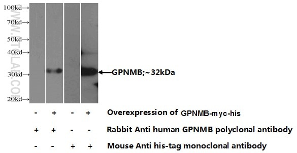 Glycoprotein Nmb Antibodies | AntibodyResource.com
