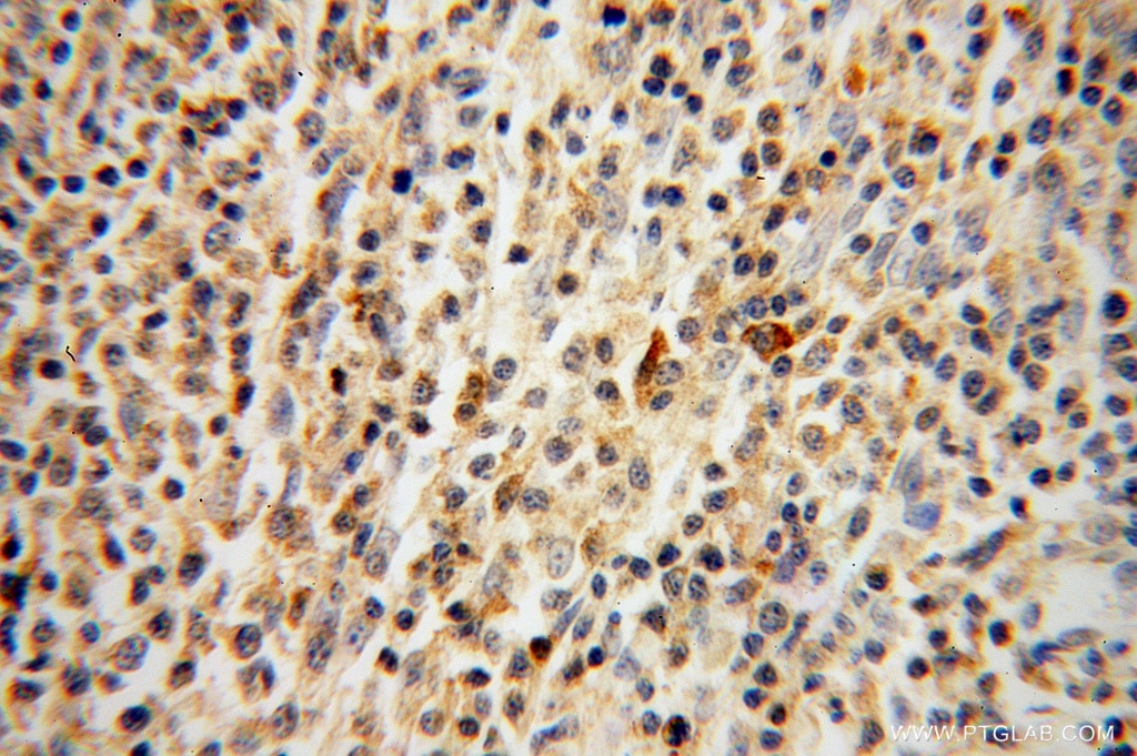 Granzyme B Antibodies for Immunofluorescence - Antibody Resource Page