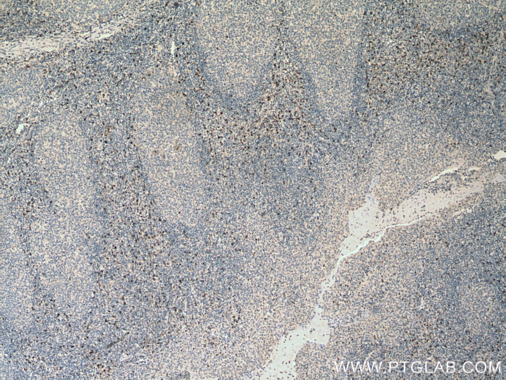 Granzyme K antibody (67272-1-Ig) | Proteintech