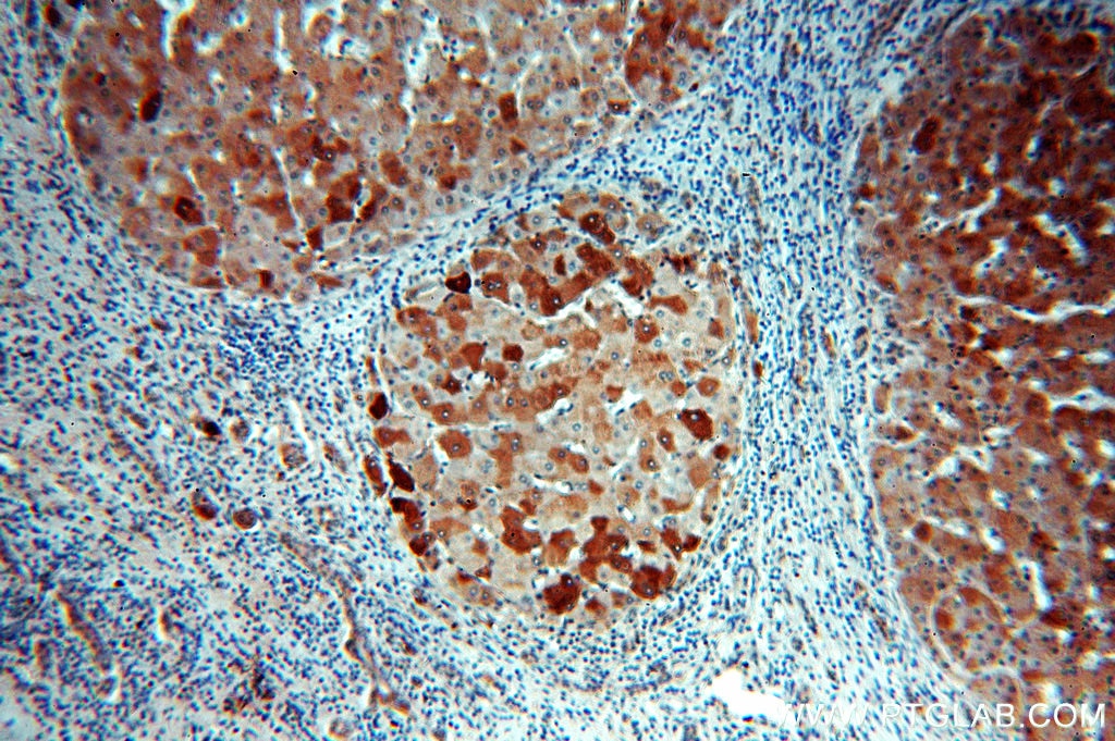H6PD antibody (15255-1-AP) | Proteintech