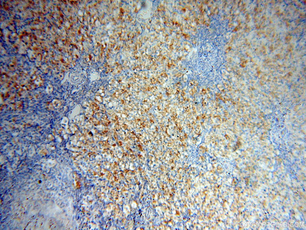 HADHA Antibody 10758-1-AP | Proteintech