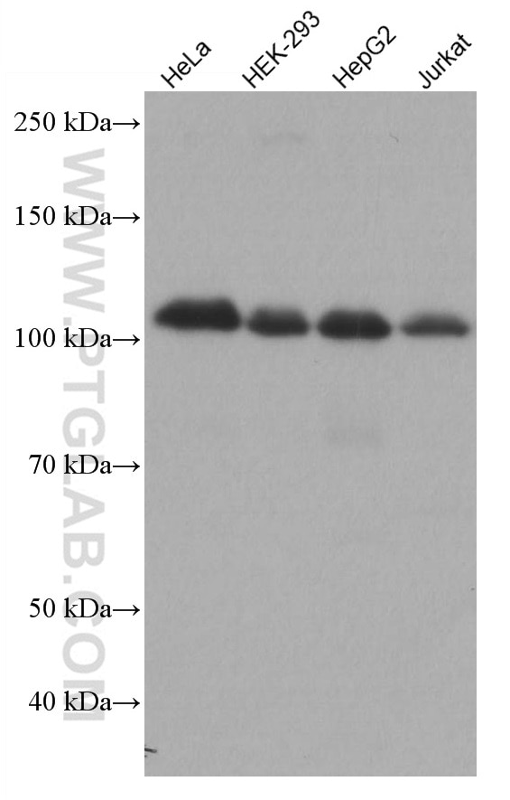 Hexokinase 2 Antibody 66974-1-Ig | Proteintech