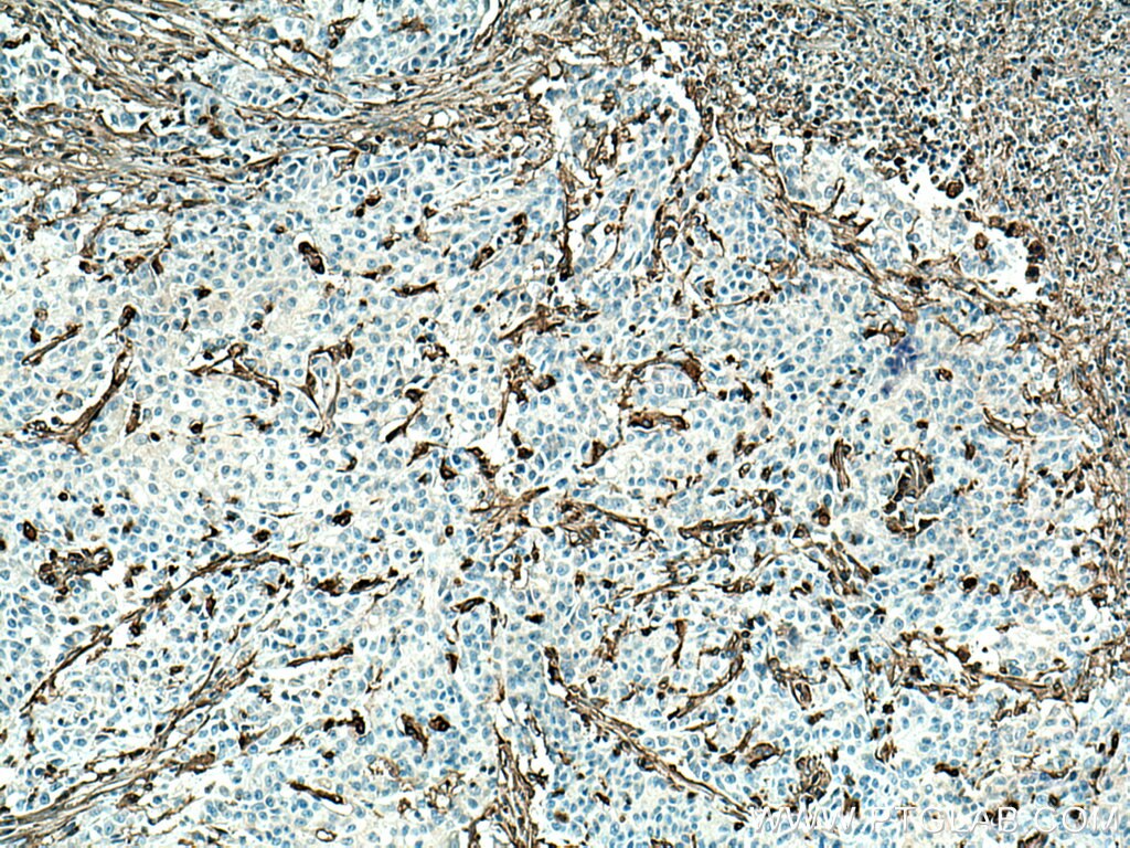 HLA class I ABC Antibody 15240-1-AP | Proteintech