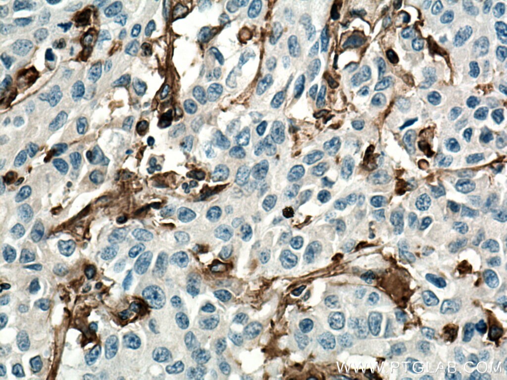 HLA class I ABC Antibody 15240-1-AP | Proteintech