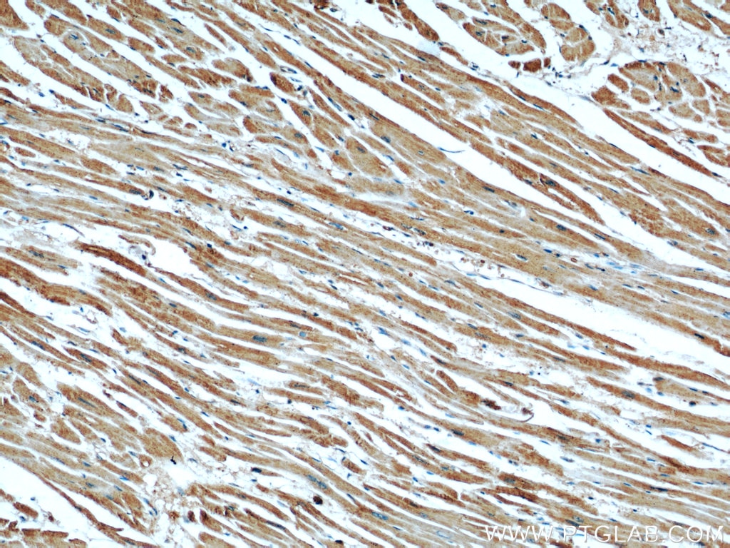 HLA class I ABC Antibody 66013-1-Ig | Proteintech