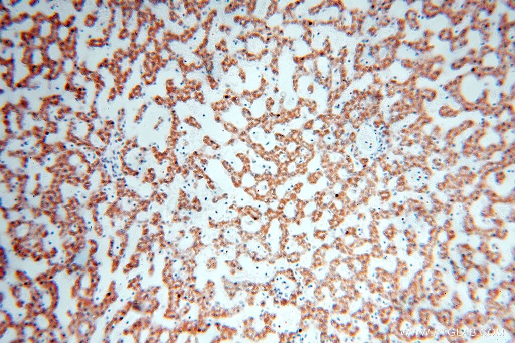 HMGCL antibody (16898-1-AP) | Proteintech