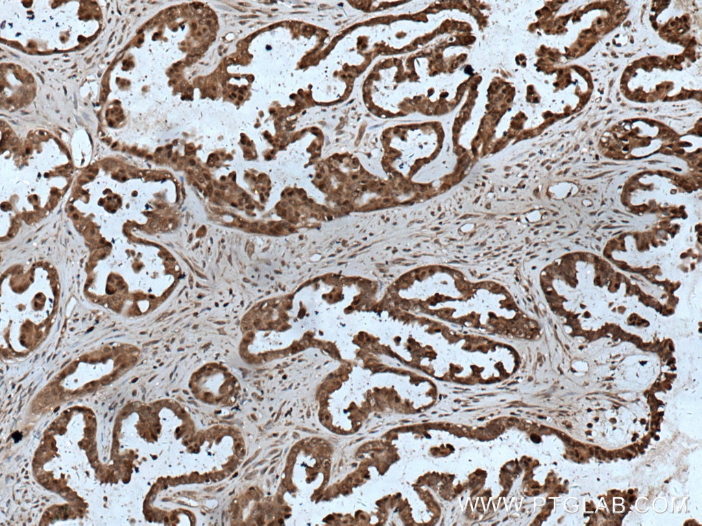 HN1 antibody (14914-1-AP) | Proteintech