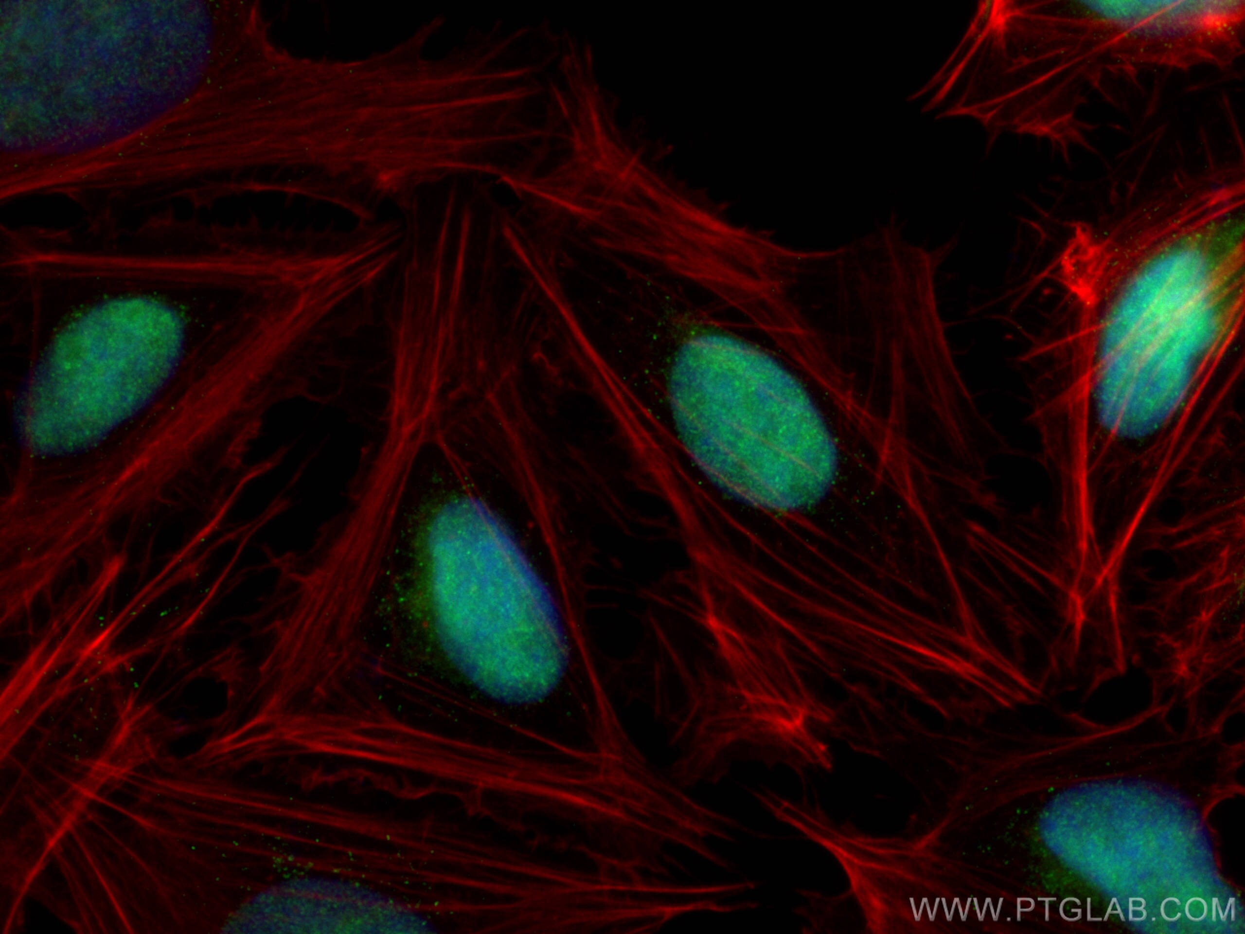 HOXD3 antibody (10496-1-PBS) | Proteintech