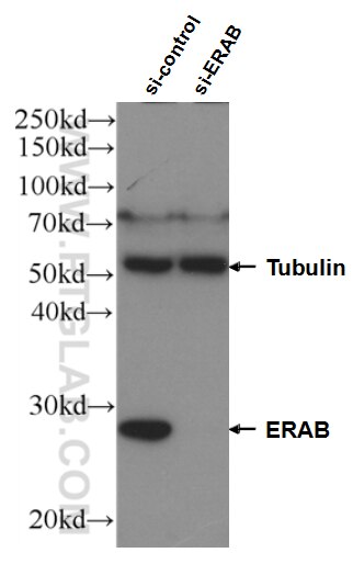ERAB antibody (10648-1-AP) | Proteintech
