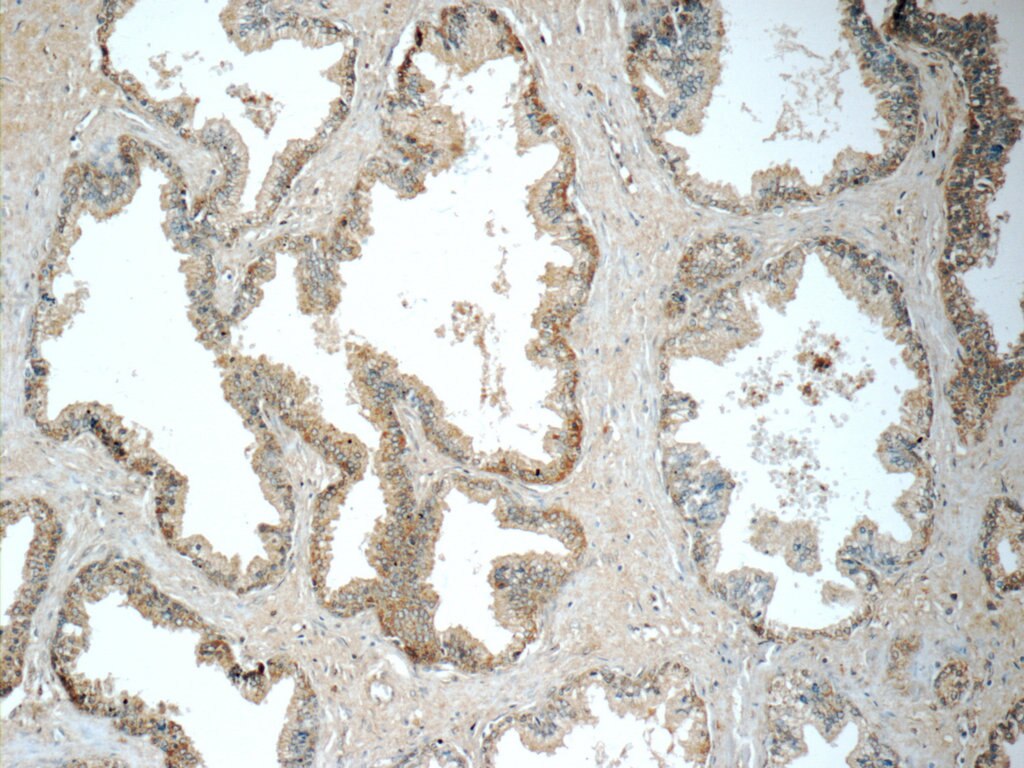 HSD17B6 antibody (11855-1-AP) | Proteintech