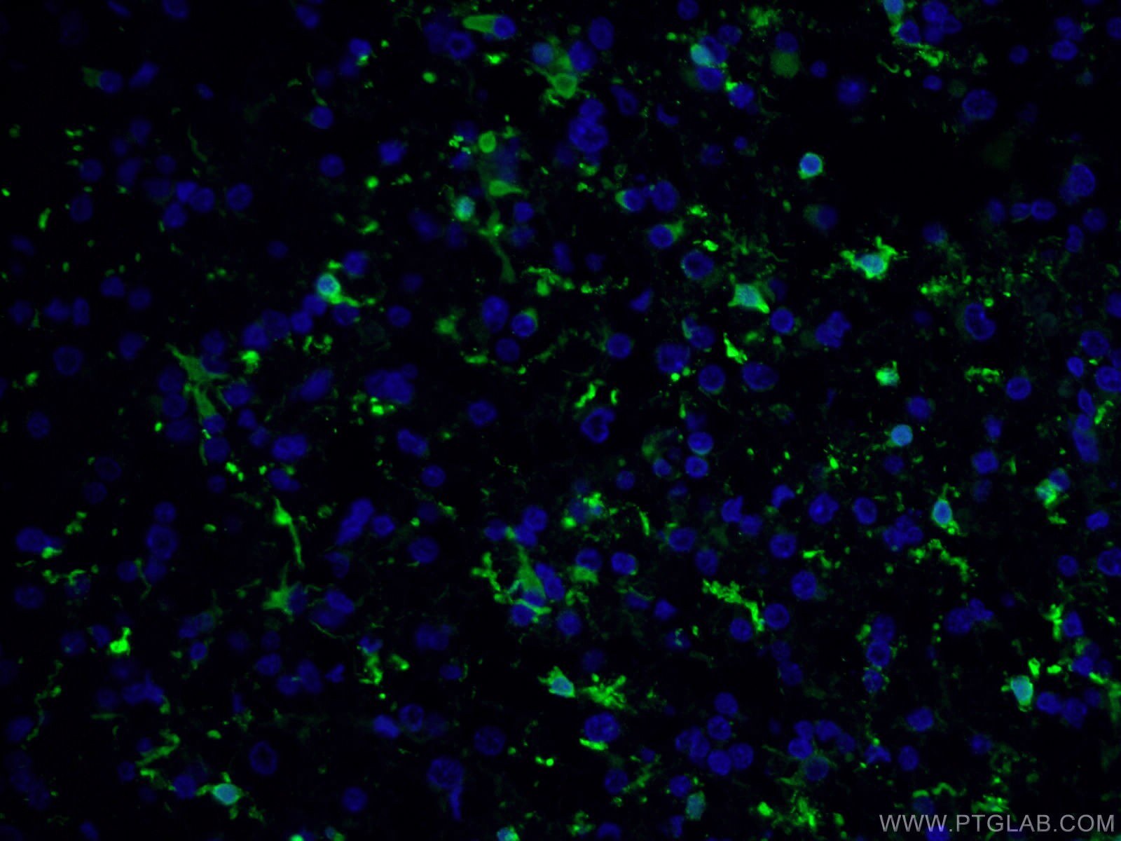 IBA1 Antibody 10904-1-AP | Proteintech