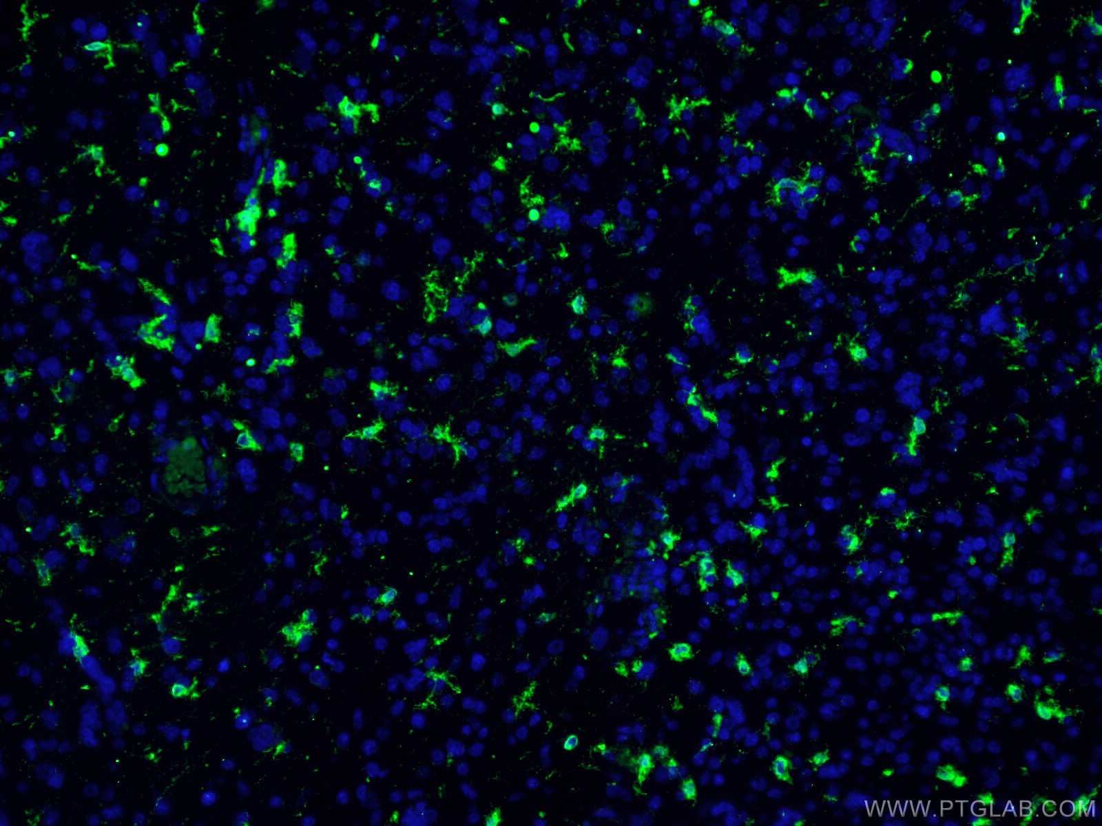 IBA1 Antibody 10904-1-AP | Proteintech