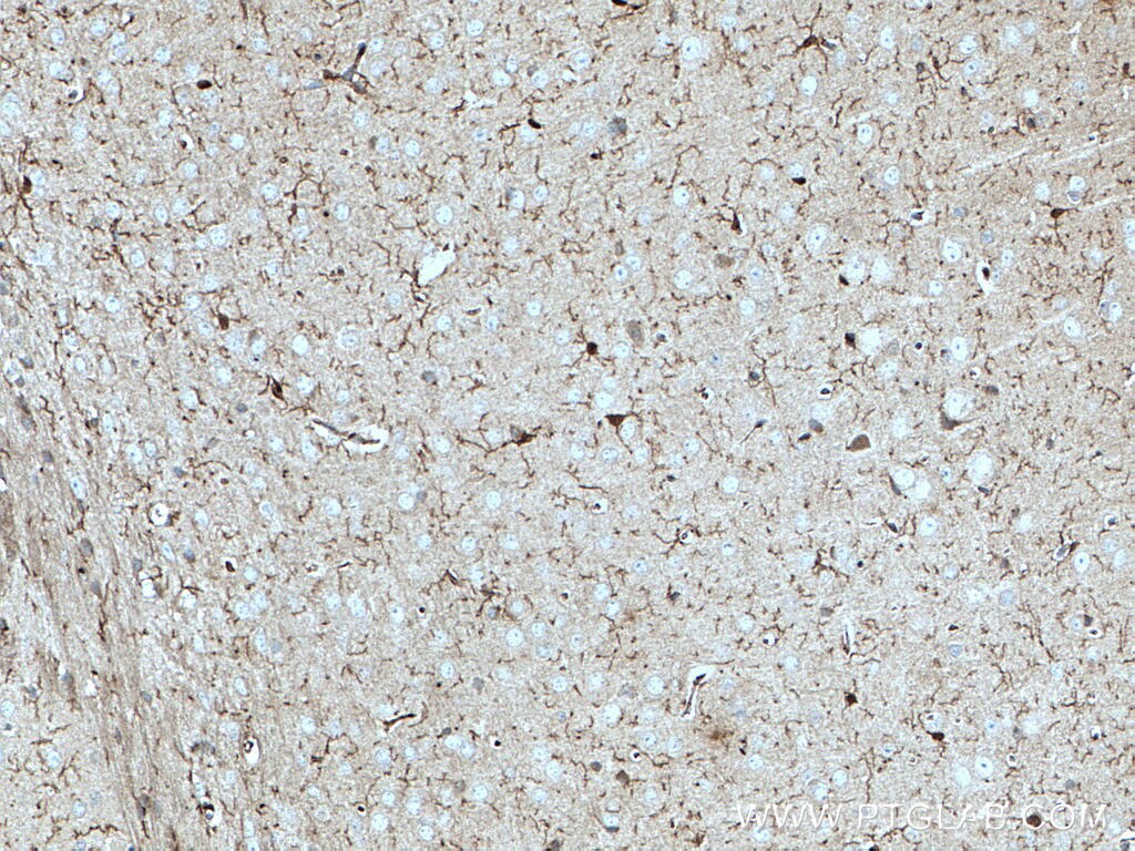 IBA1 Antibody 10904-1-AP | Proteintech