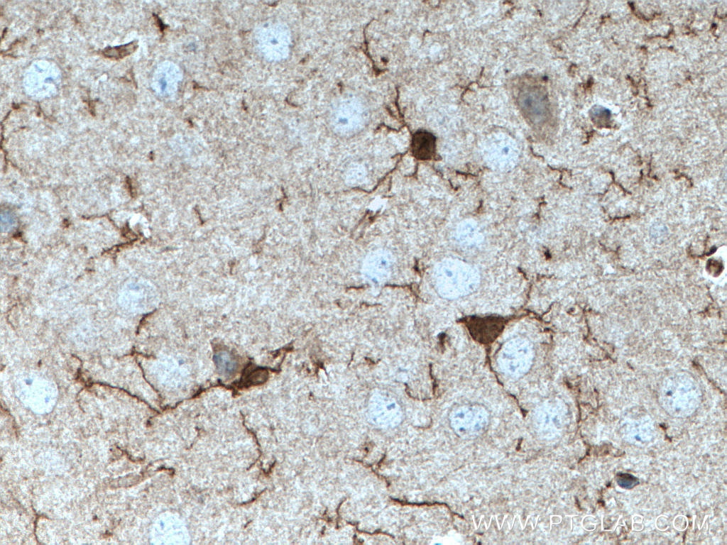 IBA1 Antibody 10904-1-AP | Proteintech