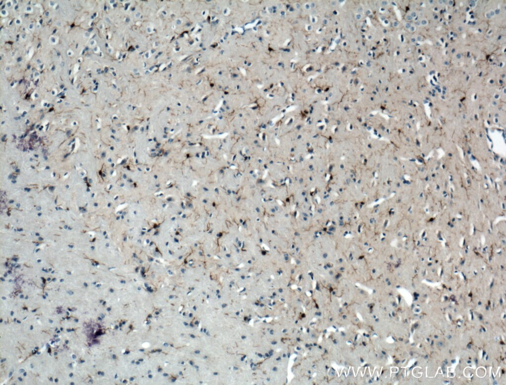 IBA1 Antibody 10904-1-AP | Proteintech