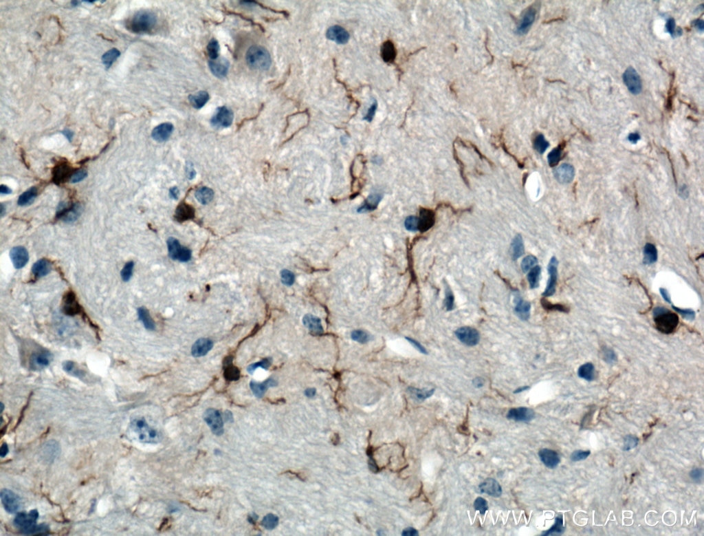 IBA1 Antibody 10904-1-AP | Proteintech