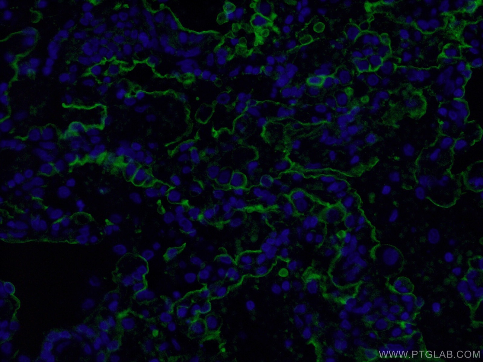 ICAM-1 Antibody 10831-1-AP | Proteintech