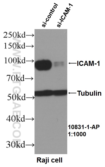 ICAM-1 antibody (10831-1-AP) | Proteintech