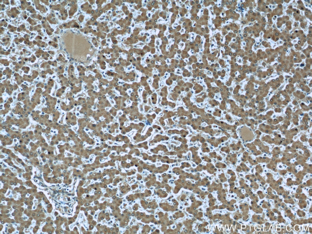 Iduronate 2 sulfatase antibody (66112-1-PBS) | Proteintech